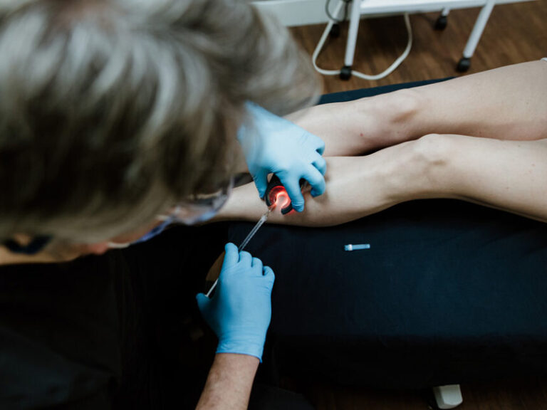 Phlebectomy Vein Procedure in the Greater Edmonton Area