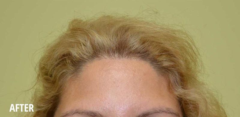 Patient Stories at Advanced Hair & Skin Surgery in Edmonton